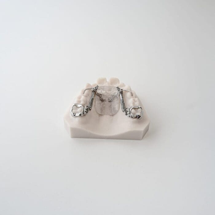 Distalization | ODL Orthodontic Labs