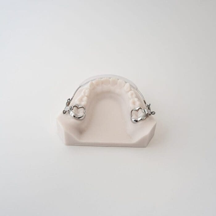 Lip Bumper | ODL Orthodontic Labs