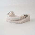Lip Bumper | ODL Orthodontic Labs