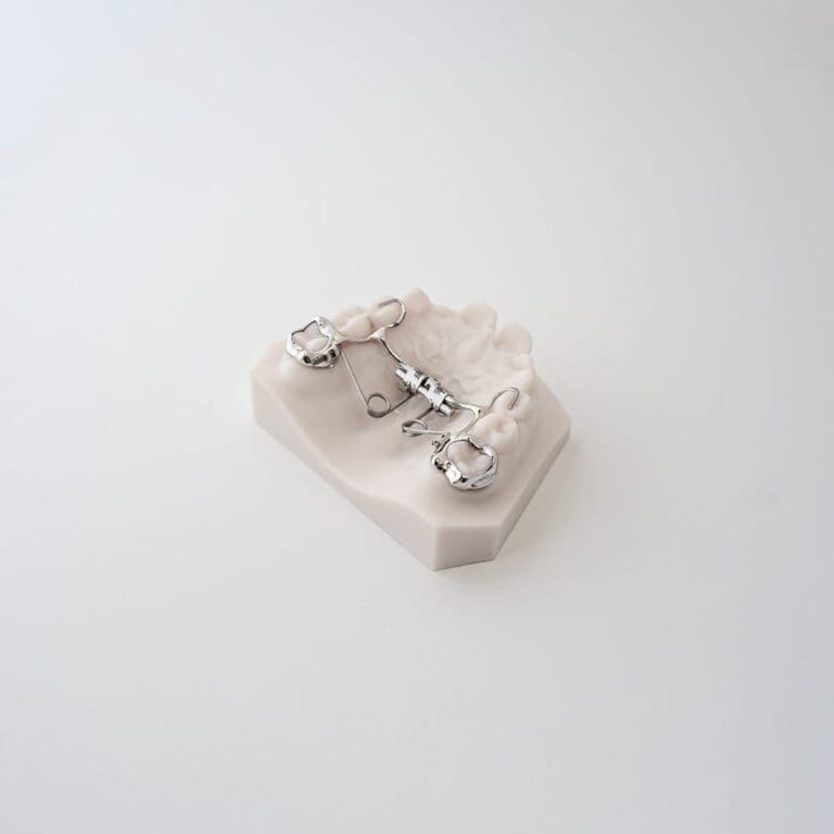 MDA (Mini Distalizing Appliance) | ODL Orthodontic Labs