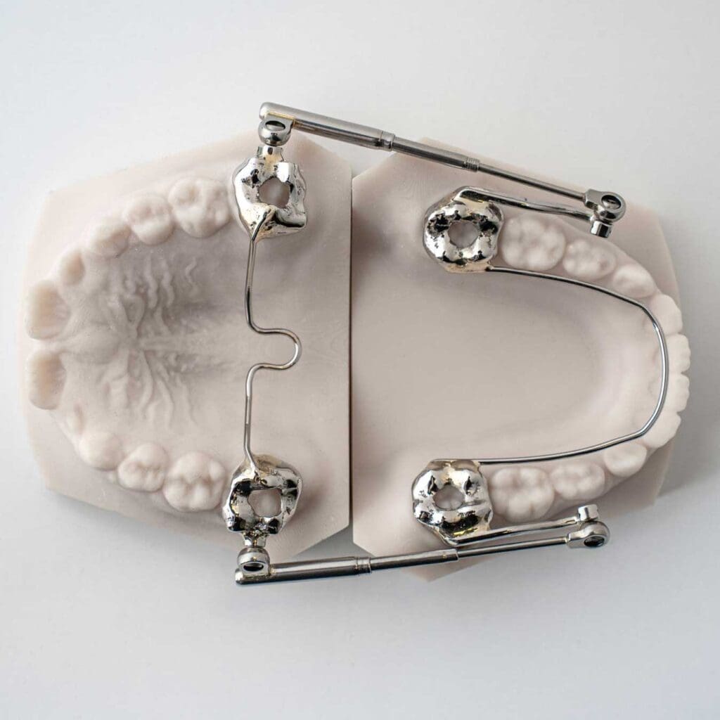 Miniscope Herbst | ODL Orthodontic Labs