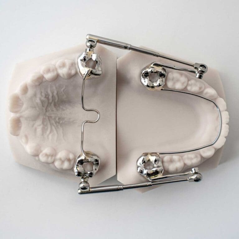 Miniscope Herbst | ODL Orthodontic Labs