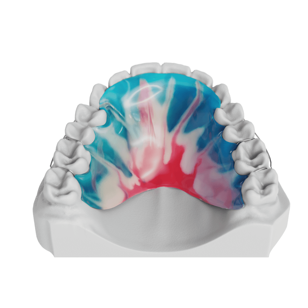 Hawley Retainers & Phase 1 | ODL Orthodontic Labs