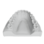 Fixed Lingual Retainers | ODL Orthodontic Labs