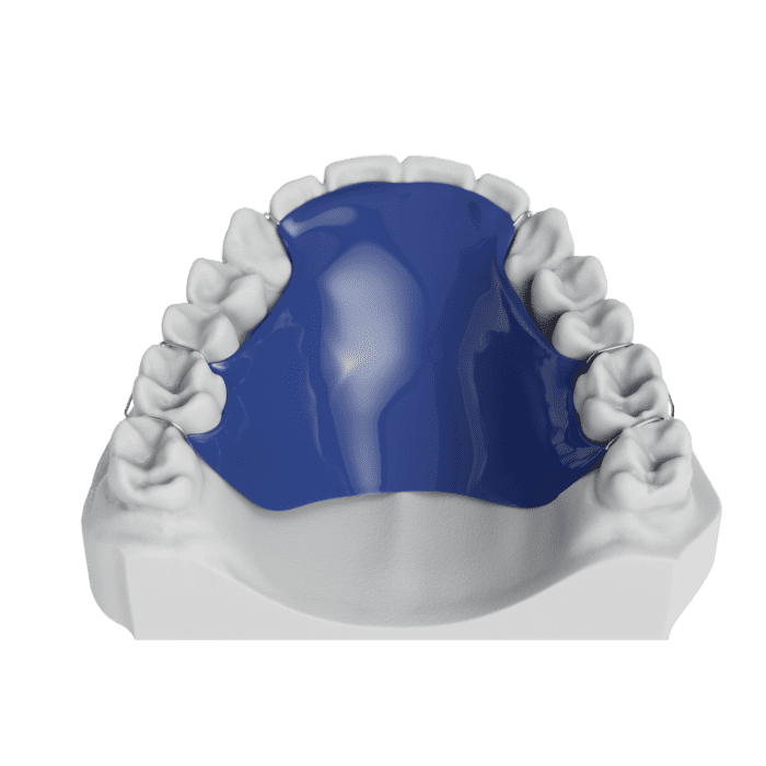 Theroux Phase 1 Retainer | ODL Orthodontic Labs