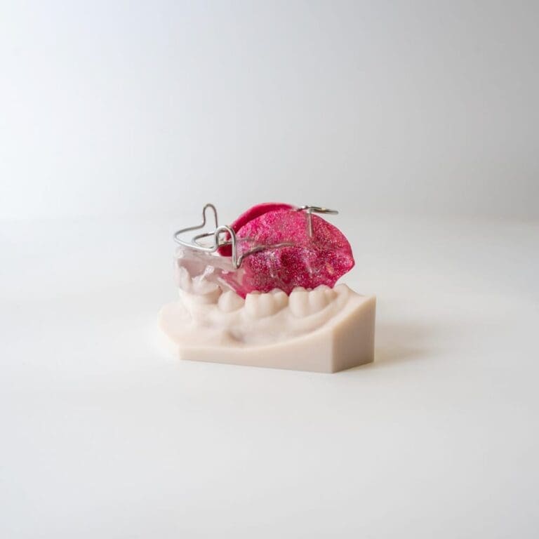 Bionator 1 & 2 | ODL Orthodontic Labs