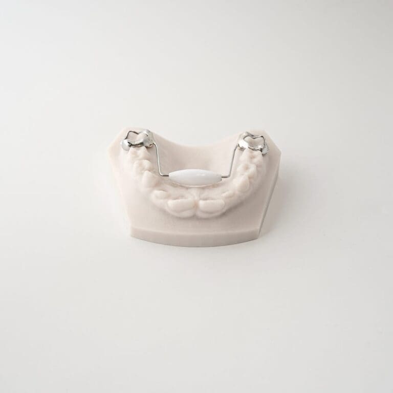 Blue Grass Appliance | ODL Orthodontic Labs