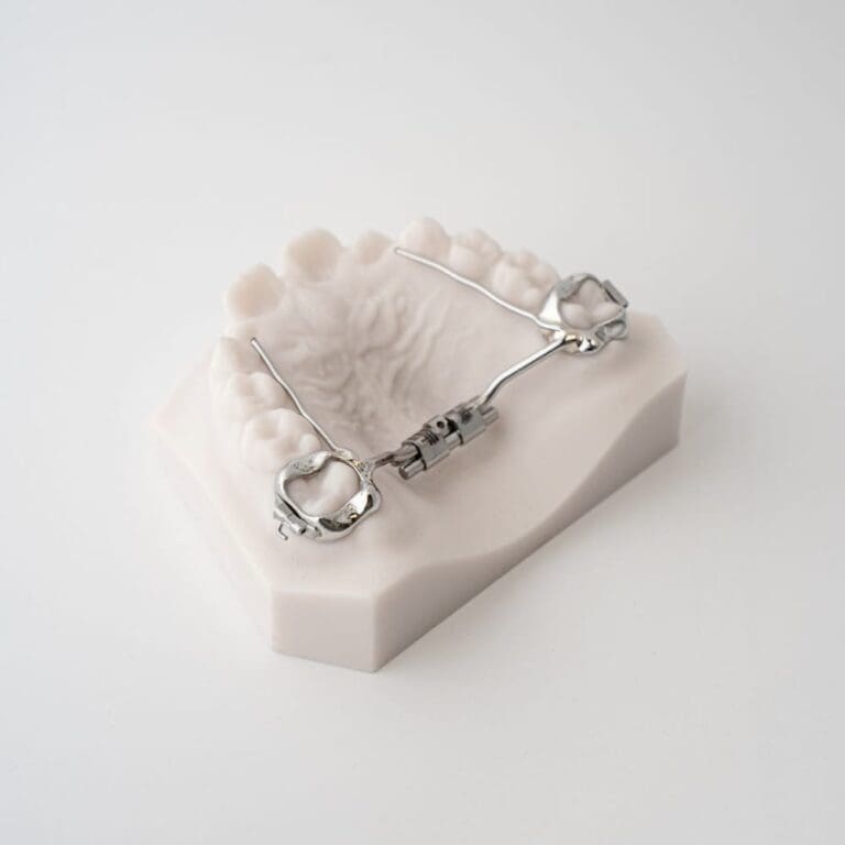 Compact RPE (Rapid Palatal Expander) | ODL Orthodontic Labs