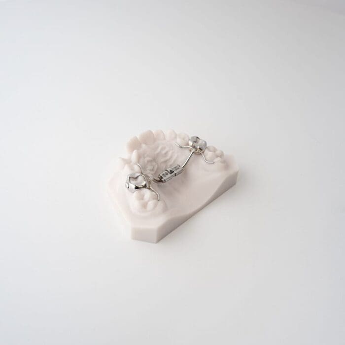 Compact RPE (Rapid Palatal Expander) | ODL Orthodontic Labs