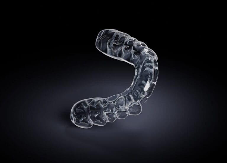Digital Anterior Repositioning Splint | ODL Orthodontic Labs