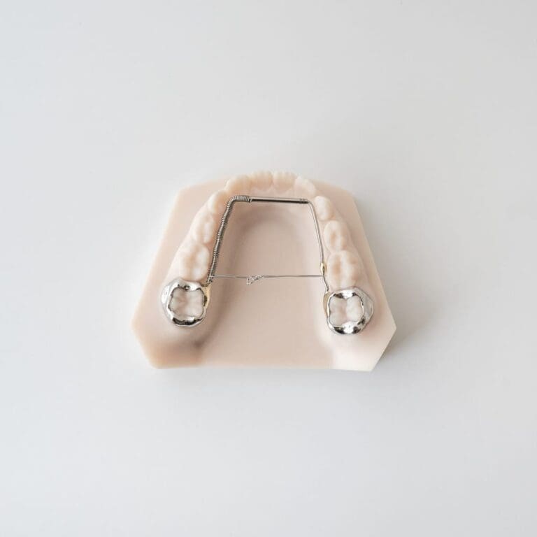 Lower E-Arch (Arnold Expander) | ODL Orthodontic Labs