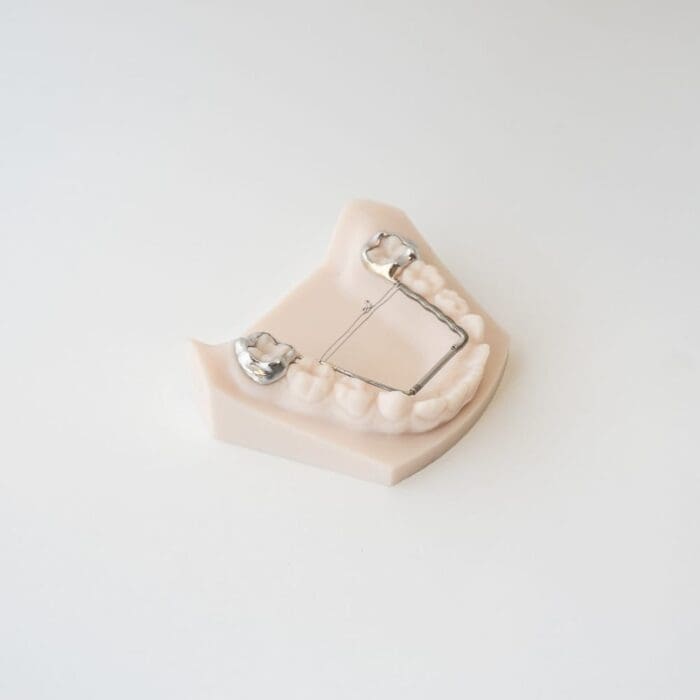 Lower E-Arch (Arnold Expander) | ODL Orthodontic Labs