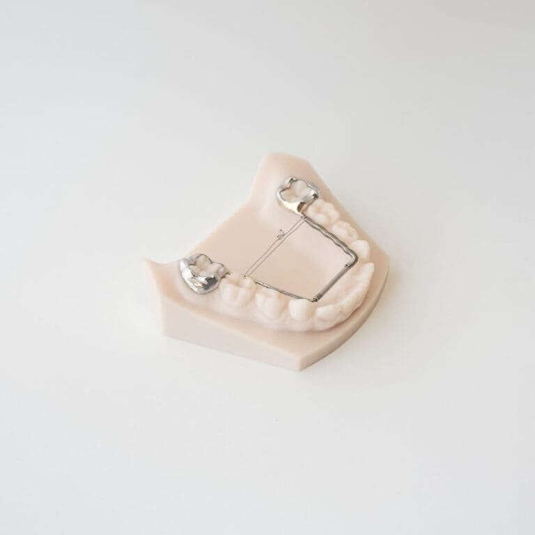 Lower E-Arch (Arnold Expander) | ODL Orthodontic Labs