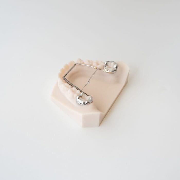 Lower E-Arch (Arnold Expander) | ODL Orthodontic Labs