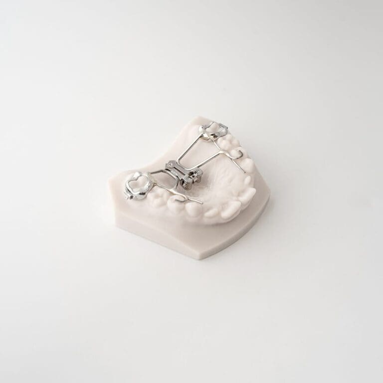 Fan RPE (Rapid Palatal Expander) | ODL Orthodontic Labs