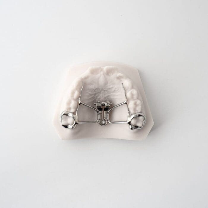 Fan RPE (Rapid Palatal Expander) | ODL Orthodontic Labs