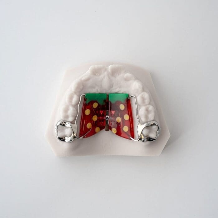 HAAS Expander | ODL Orthodontic Labs