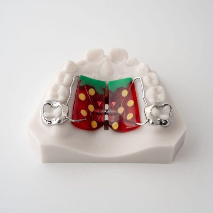 HAAS Expander | ODL Orthodontic Labs