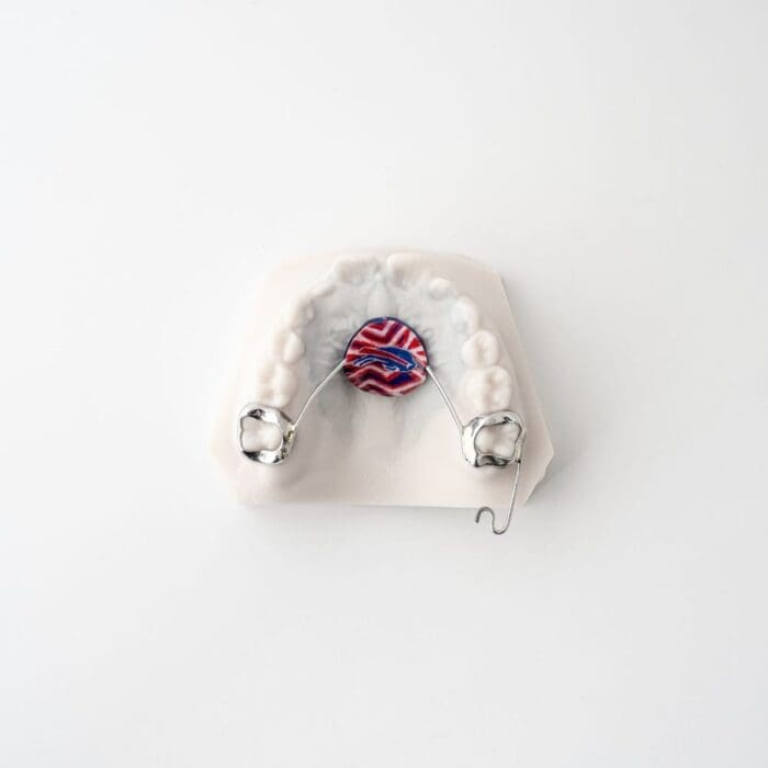 HAAS Expander | ODL Orthodontic Labs