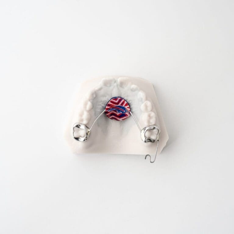 HAAS Expander | ODL Orthodontic Labs