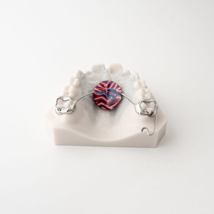 Tpa Transpalatal Arch Odl Orthodontic Labs