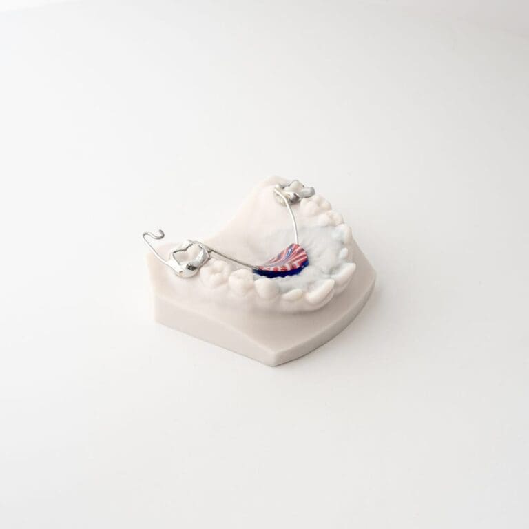 HAAS Expander | ODL Orthodontic Labs