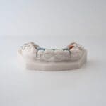 Hawley Retainers & Phase 1 | ODL Orthodontic Labs