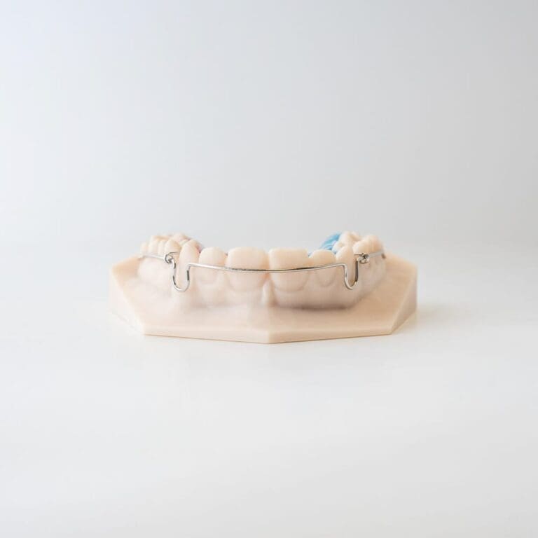 Hawley Wraparound | ODL Orthodontic Labs