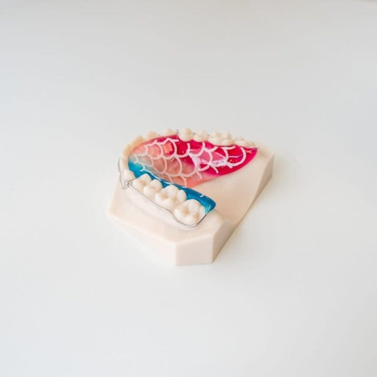 Hawley Wraparound | ODL Orthodontic Labs