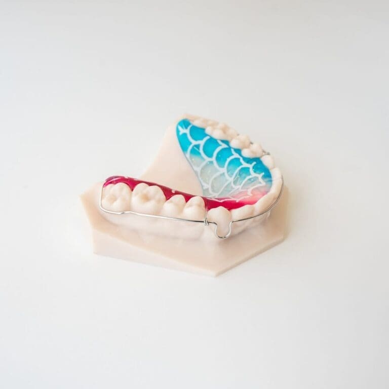 Hawley Wraparound | ODL Orthodontic Labs