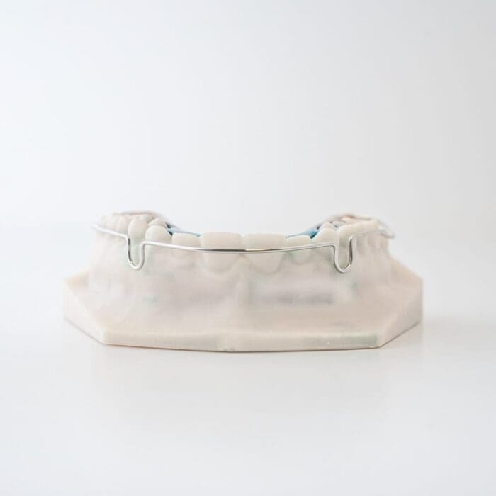 Hawley Wraparound | ODL Orthodontic Labs