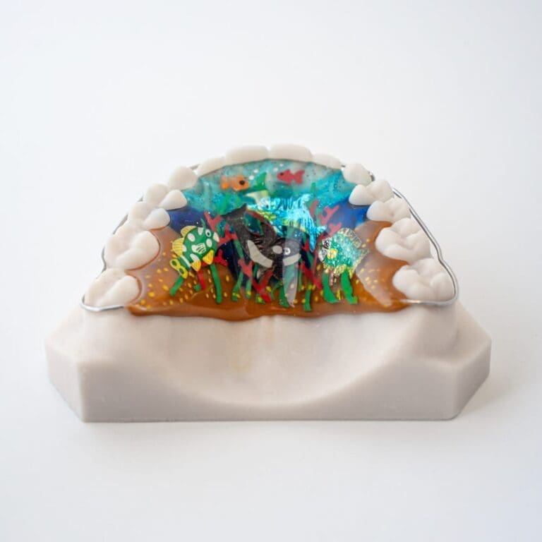 Hawley Wraparound | ODL Orthodontic Labs