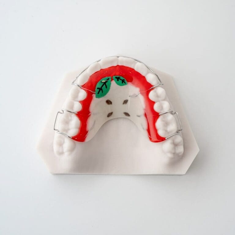 Hawley Retainers & Phase 1 | ODL Orthodontic Labs