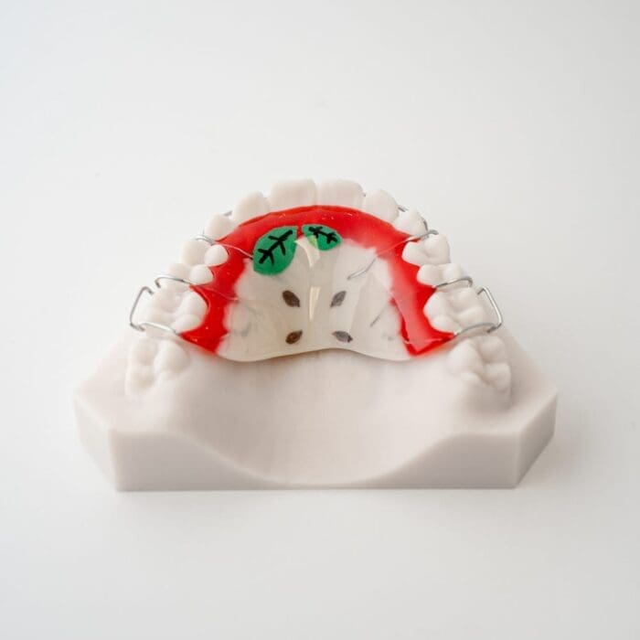 Hawley Retainers & Phase 1 | ODL Orthodontic Labs