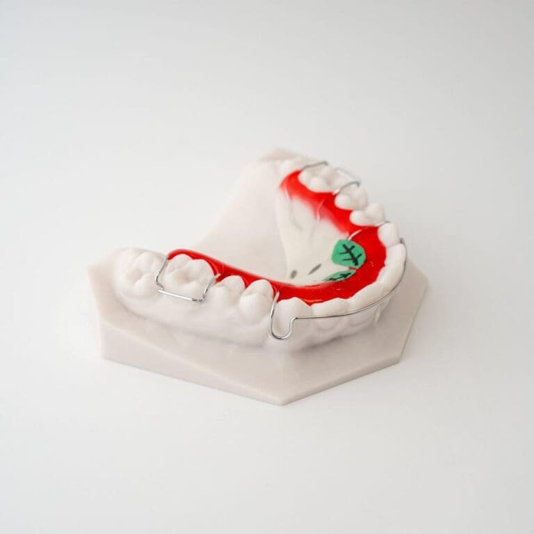 Hawley Retainers & Phase 1 | ODL Orthodontic Labs