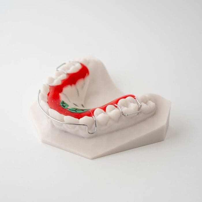 Hawley Retainers & Phase 1 | ODL Orthodontic Labs