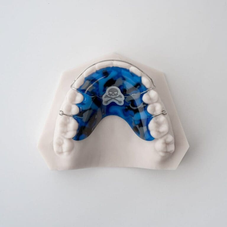 Hawley Retainers & Phase 1 | ODL Orthodontic Labs