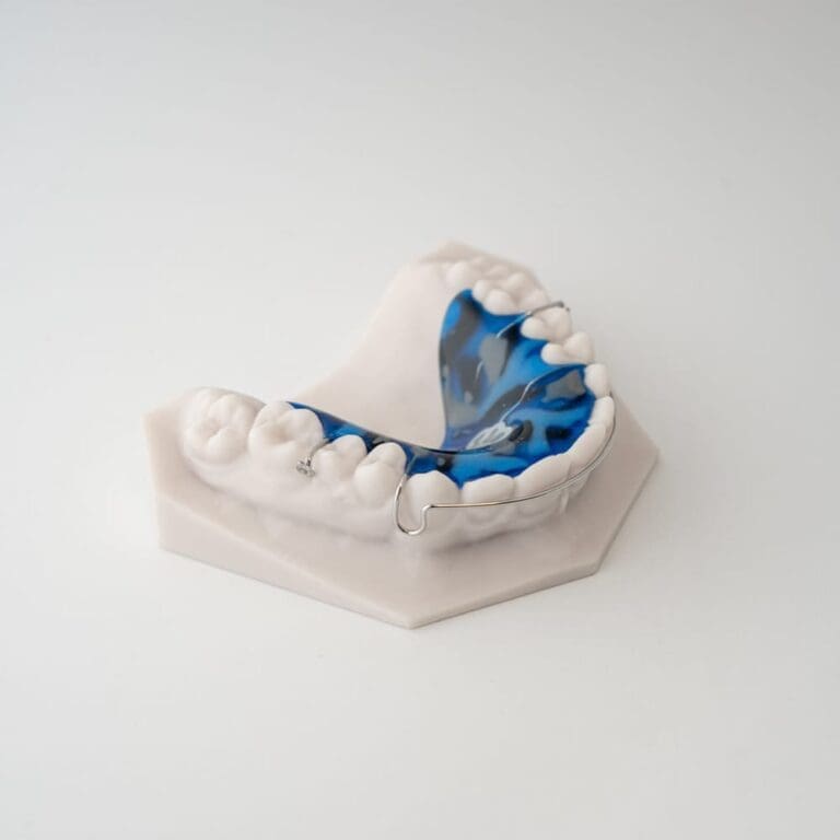 Hawley Retainers & Phase 1 | ODL Orthodontic Labs
