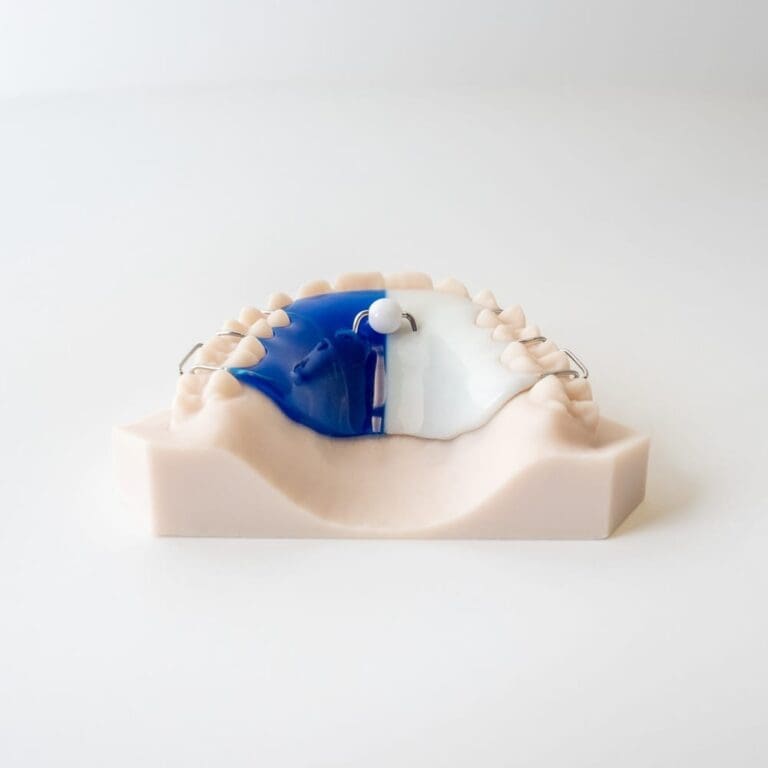 Habit Breaking Appliances | ODL Orthodontic Labs