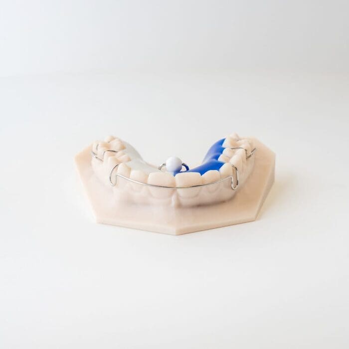Habit Breaking Appliances | ODL Orthodontic Labs