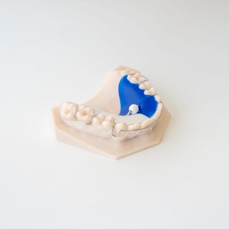 Habit Breaking Appliances | ODL Orthodontic Labs