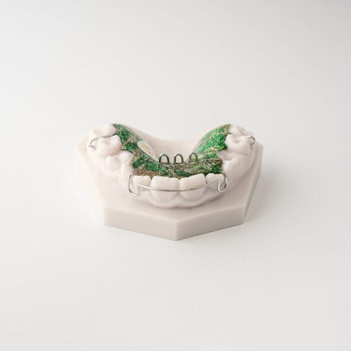 Hawley w Tongue Crib | ODL Orthodontic Labs