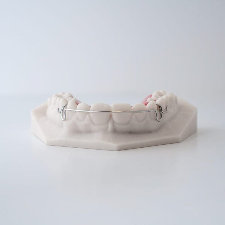 Hawley with Welded c-clasps | ODL Orthodontic Labs