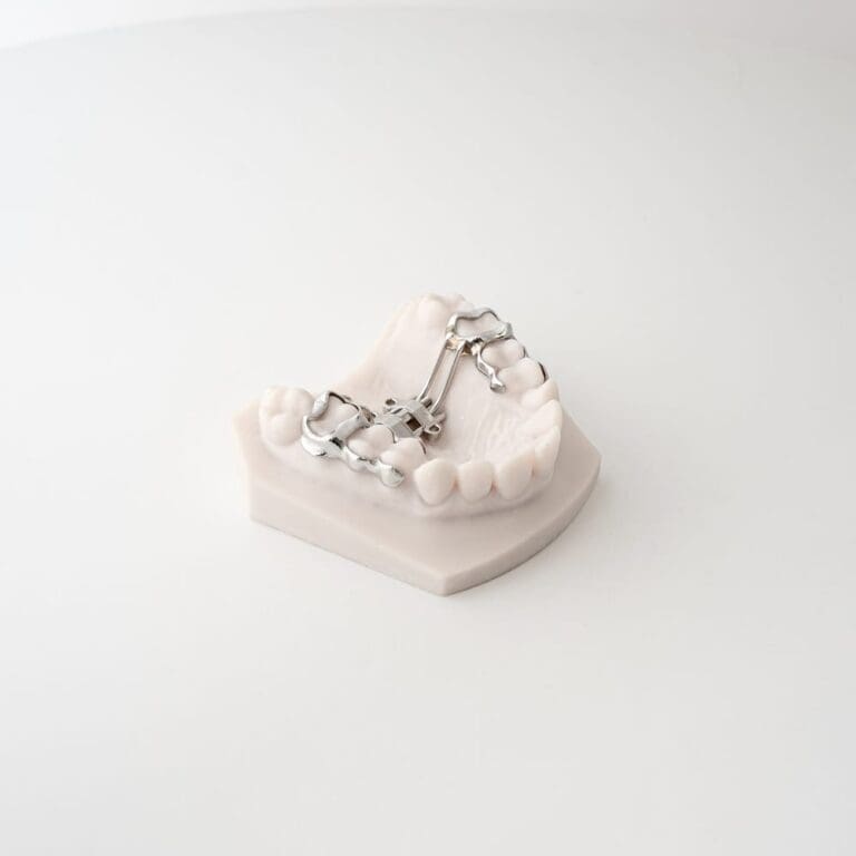 TAD Appliances for Airway Expansion | ODL Orthodontic Labs