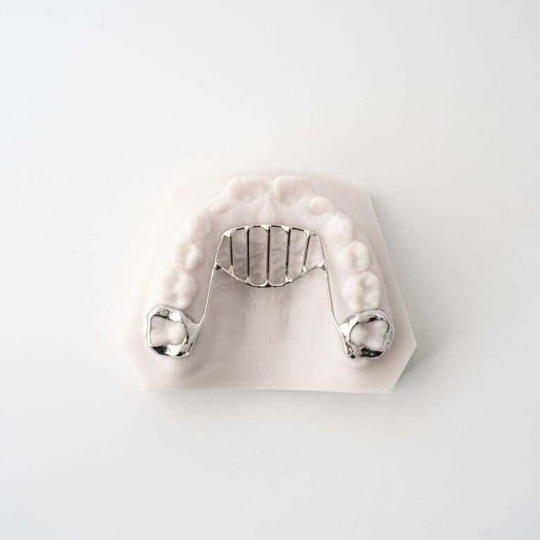 Palatal Thumb Crib | ODL Orthodontic Labs