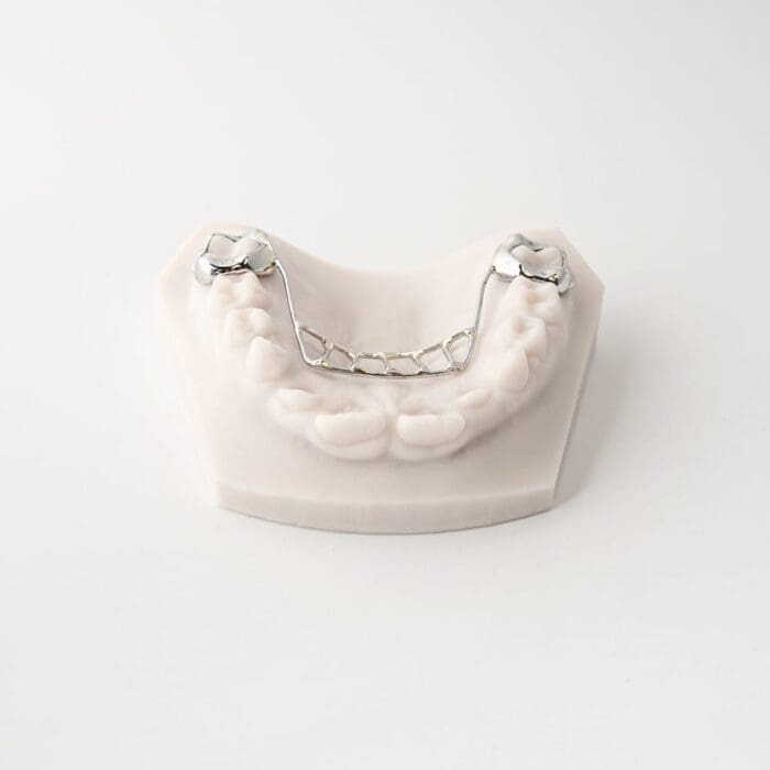 Palatal Thumb Crib | ODL Orthodontic Labs