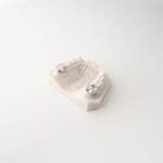 Palatal Thumb Crib | ODL Orthodontic Labs