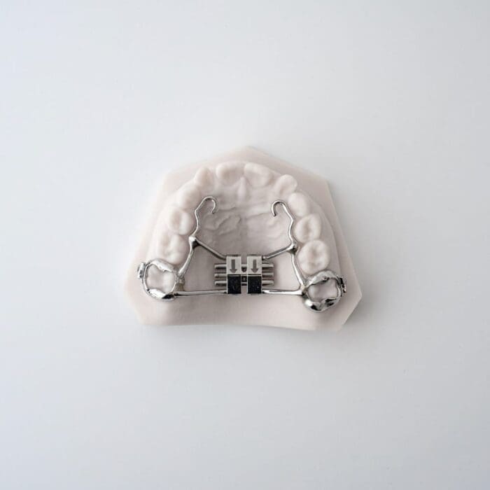 RPE w Facemask Hooks | ODL Orthodontic Labs