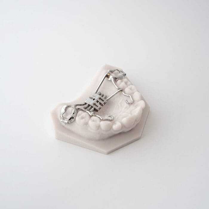 RPE w Facemask Hooks | ODL Orthodontic Labs