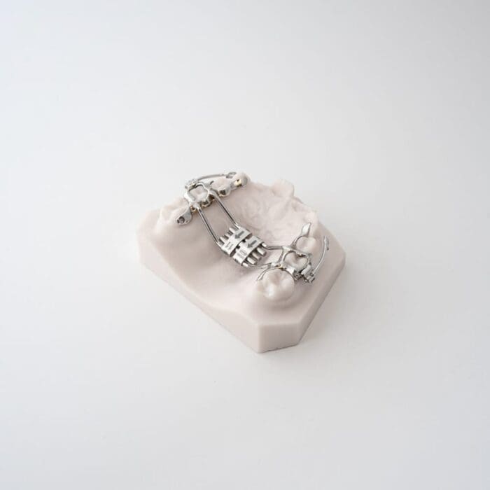 RPE w Facemask Hooks | ODL Orthodontic Labs